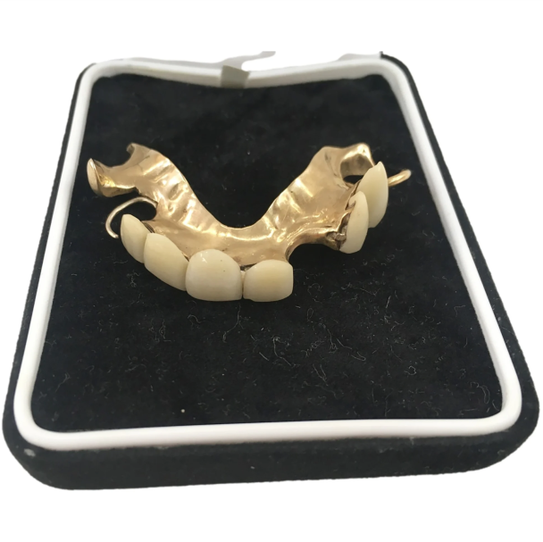 Вставну щелепу Черчилля продадуть на аукціоні – фото — Світ