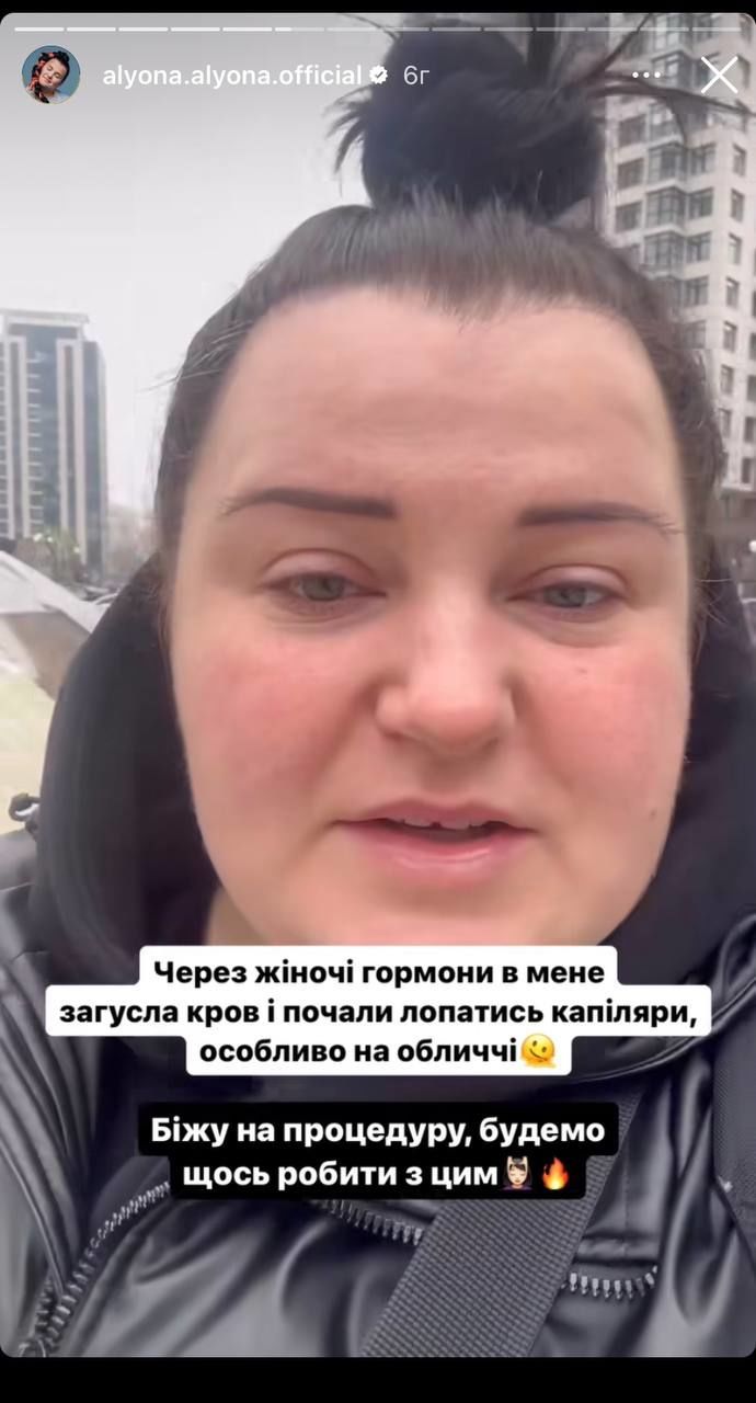 alyona alyona рассказала о серьезных проблемах со здоровьем: фото ...