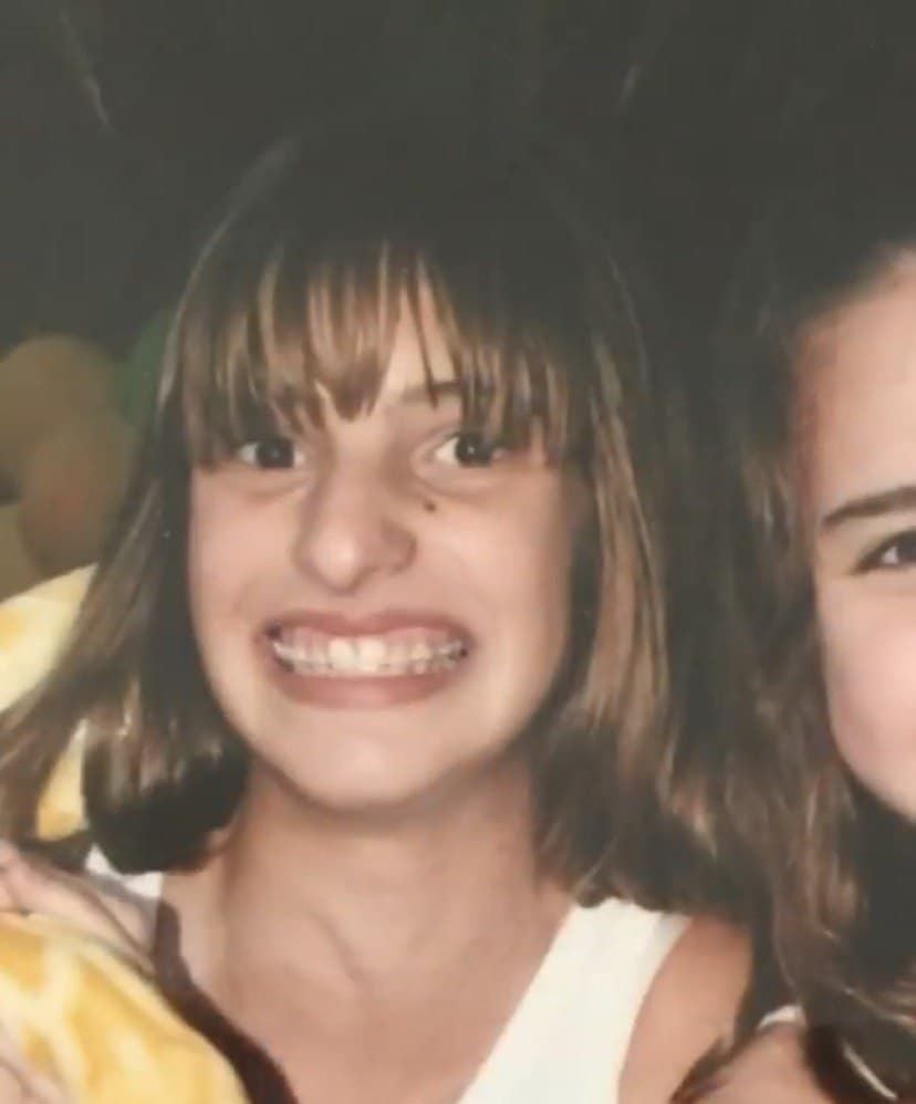 Леле Понс до і після пластики – фото та відео зірки Мережі — Гламур