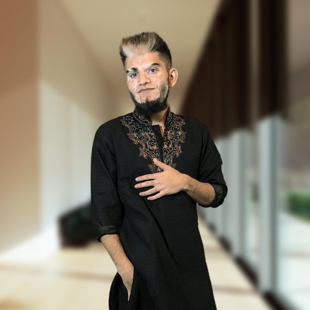 Чоловіка, якого плутають дідусем, розповів про своє рідкісне ...