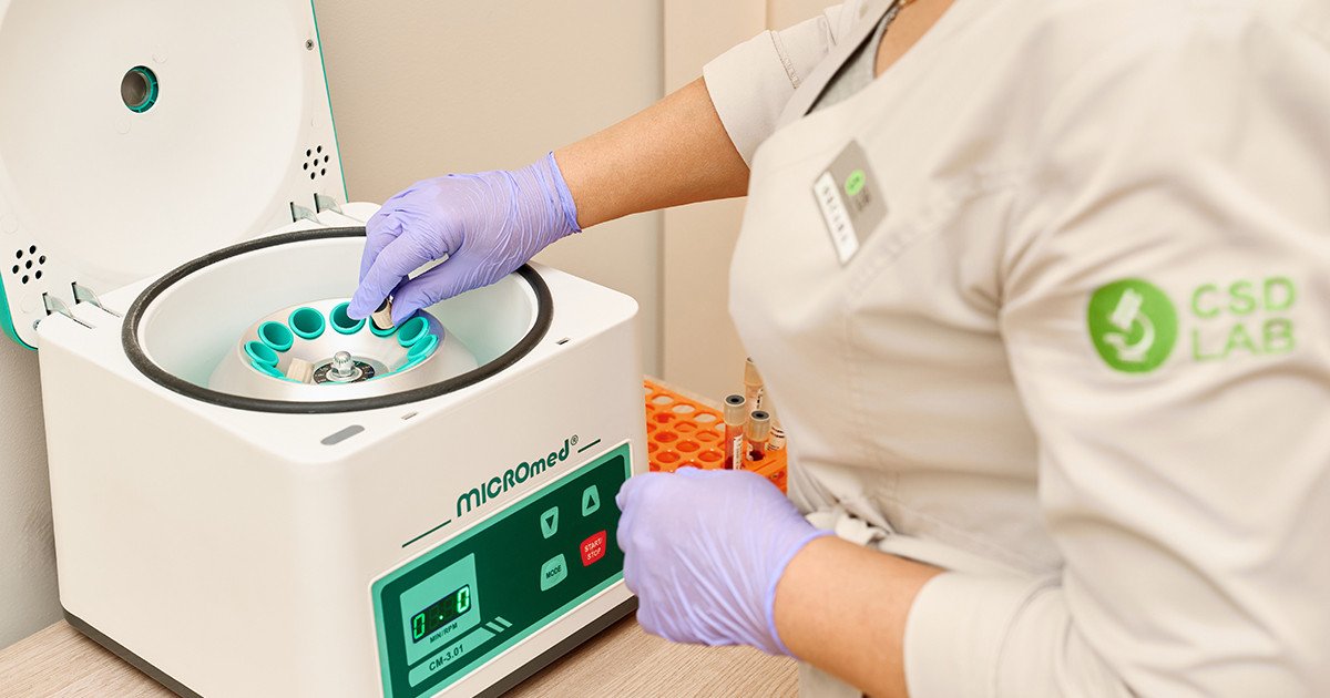 Безоплатні аналізи у приватній лабораторії: Олександр Дудін про те, як CSD LAB робить якісну ...