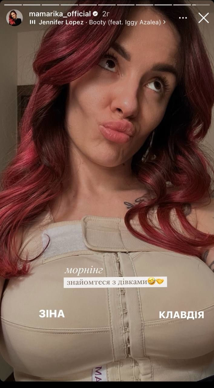 MamaRika показала свою грудь после пластической операции: фото | Новости шоу-бизнеса — Гламур