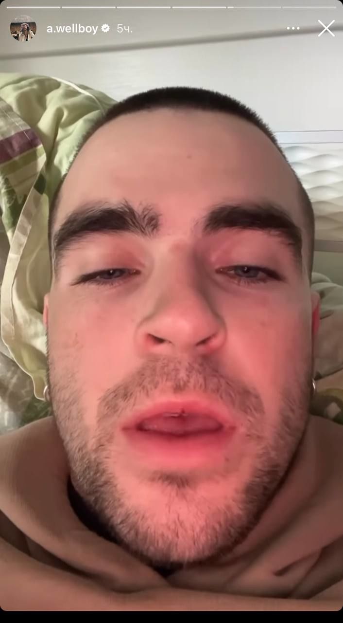 Wellboy поскаржився, що його не пустили до музею в Пирогові знімати кліп: відео і фото | Новини ...