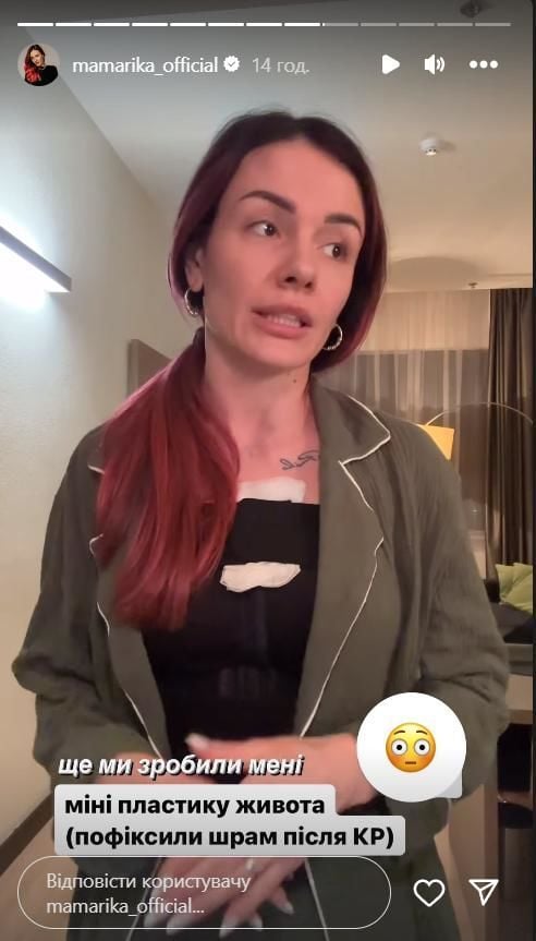 MamaRika рассекретила, что кроме подтяжки груди сделала еще одну пластическую операцию: фото ...