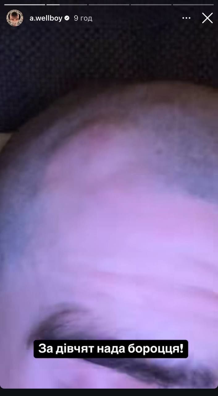 Wellboy избили в Киеве - в полиции рассказали, что произошло - фото | Новости шоу-бизнеса — Гламур